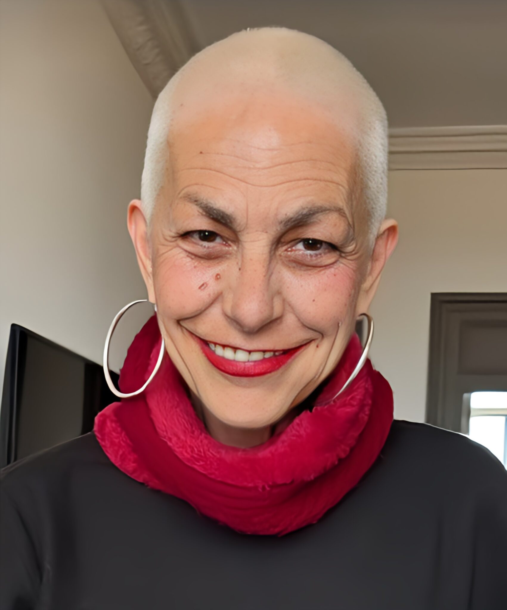 Lio irriconoscibile! Si rade la testa e si tinge di biondo! | Seguici